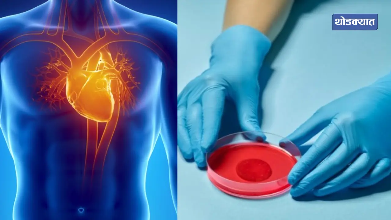 Heart Disease Healing Patch | 'हिलिंग पॅच' ठरणार हृदयरोग्यांसाठी वरदान ...
